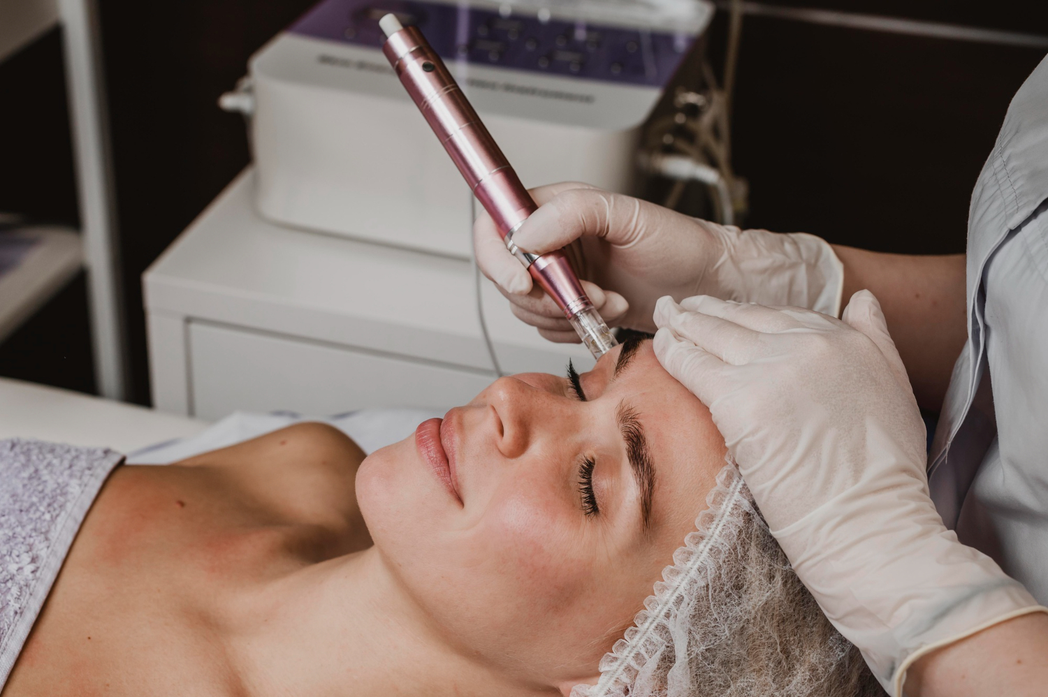 Facial + microneedling - concepcionmedicalwellness.com